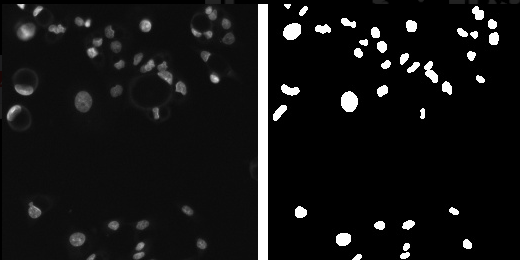 GitHub - saifgazali/Cell-Nuclei-Segmentation-using-VGG16-UNET-And ...