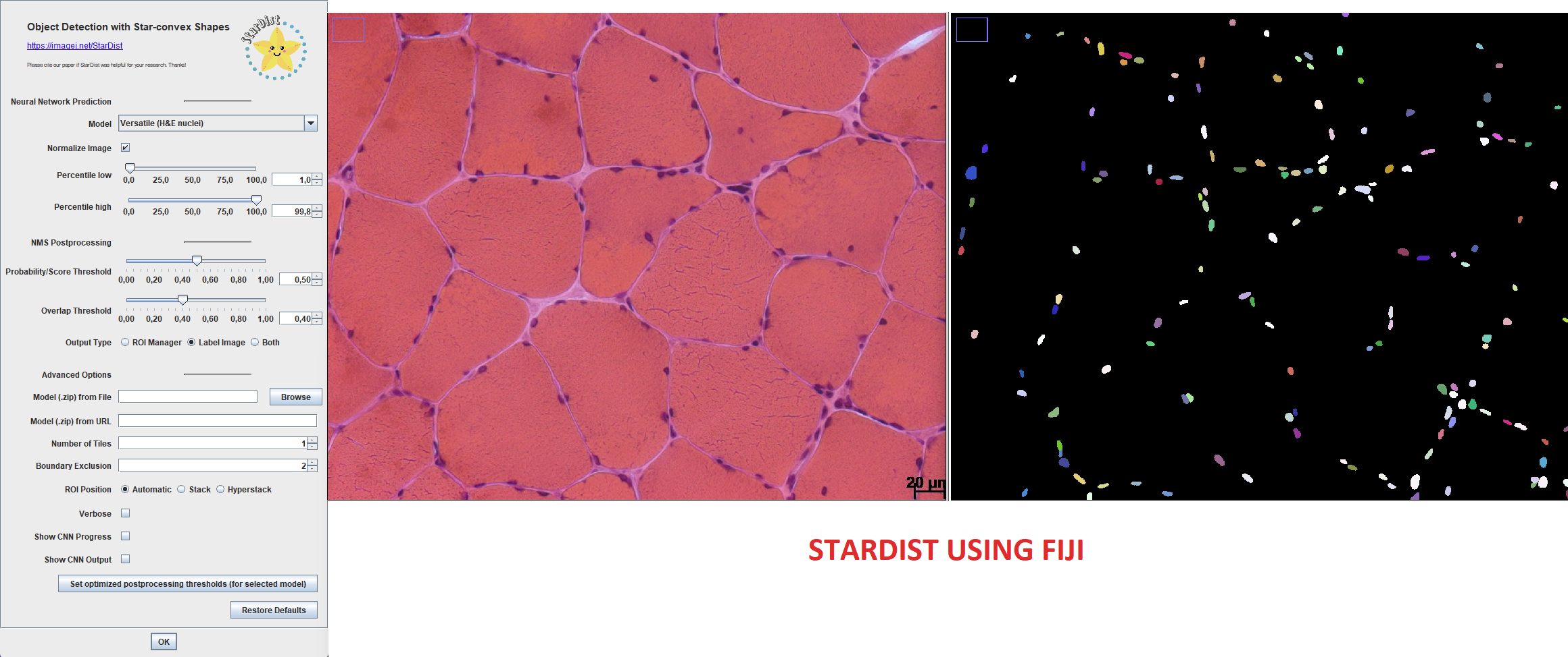 Different results from Python Stardist and FIJI · Issue #202 · stardist ...