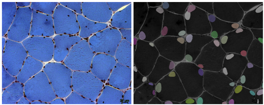 Different results from Python Stardist and FIJI · Issue #202 · stardist/stardist · GitHub