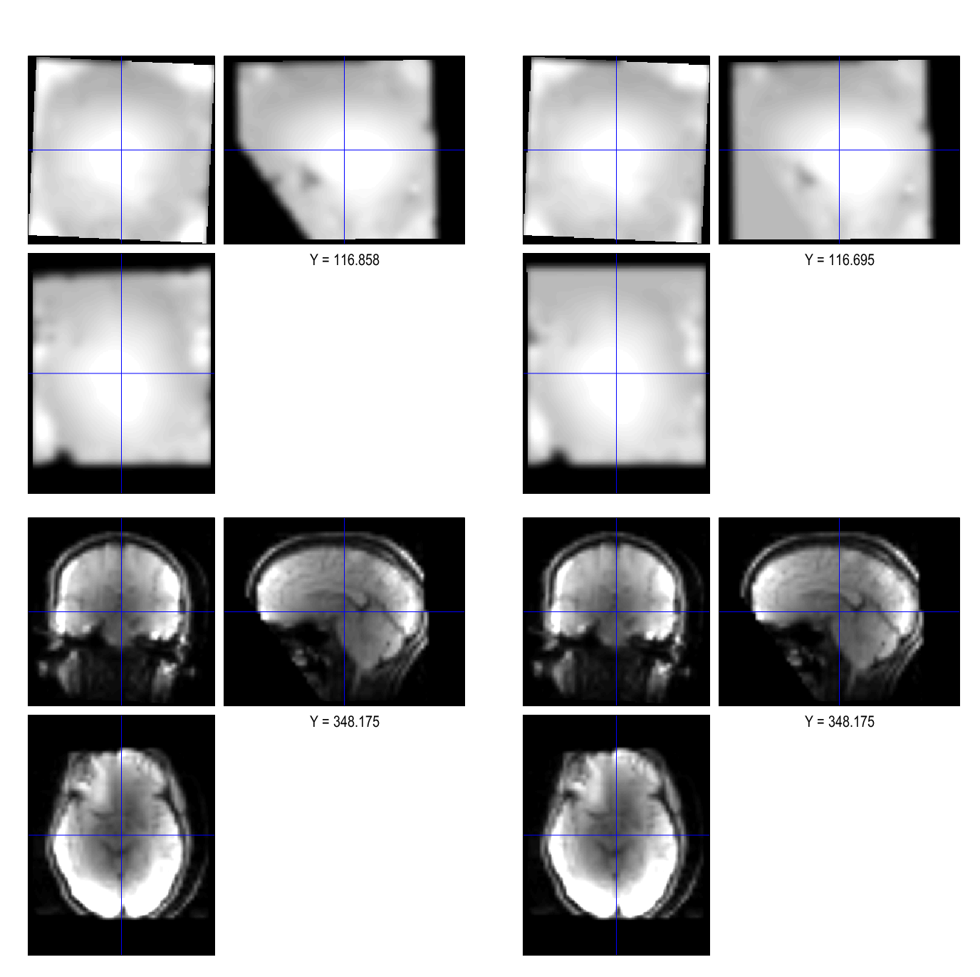 Ordering of the B1+ images for B1map estimations on demo data · Issue ...