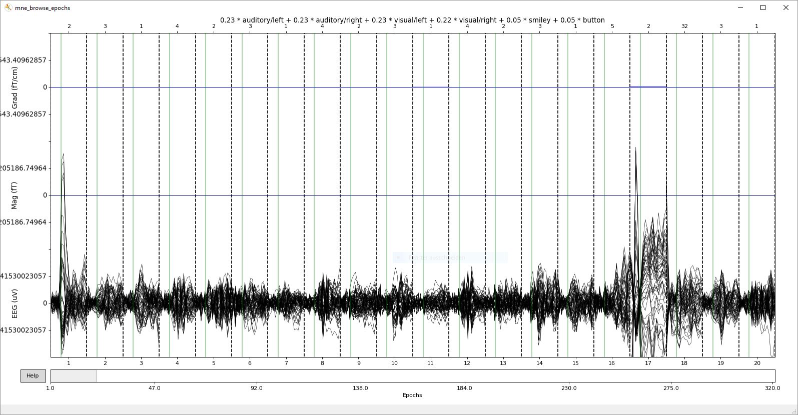 Autoscale is not working properly in epochs.plot() · Issue #6226 · mne ...