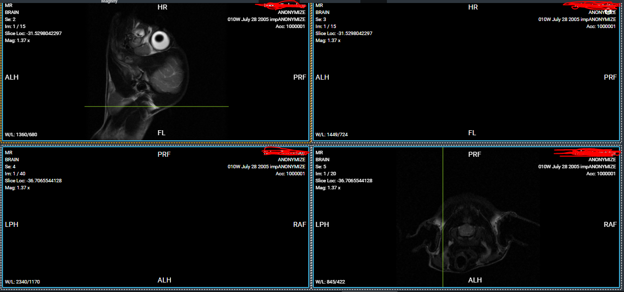 Reference line implementation, getting ImagIds and Stack · Issue #997 · cornerstonejs ...