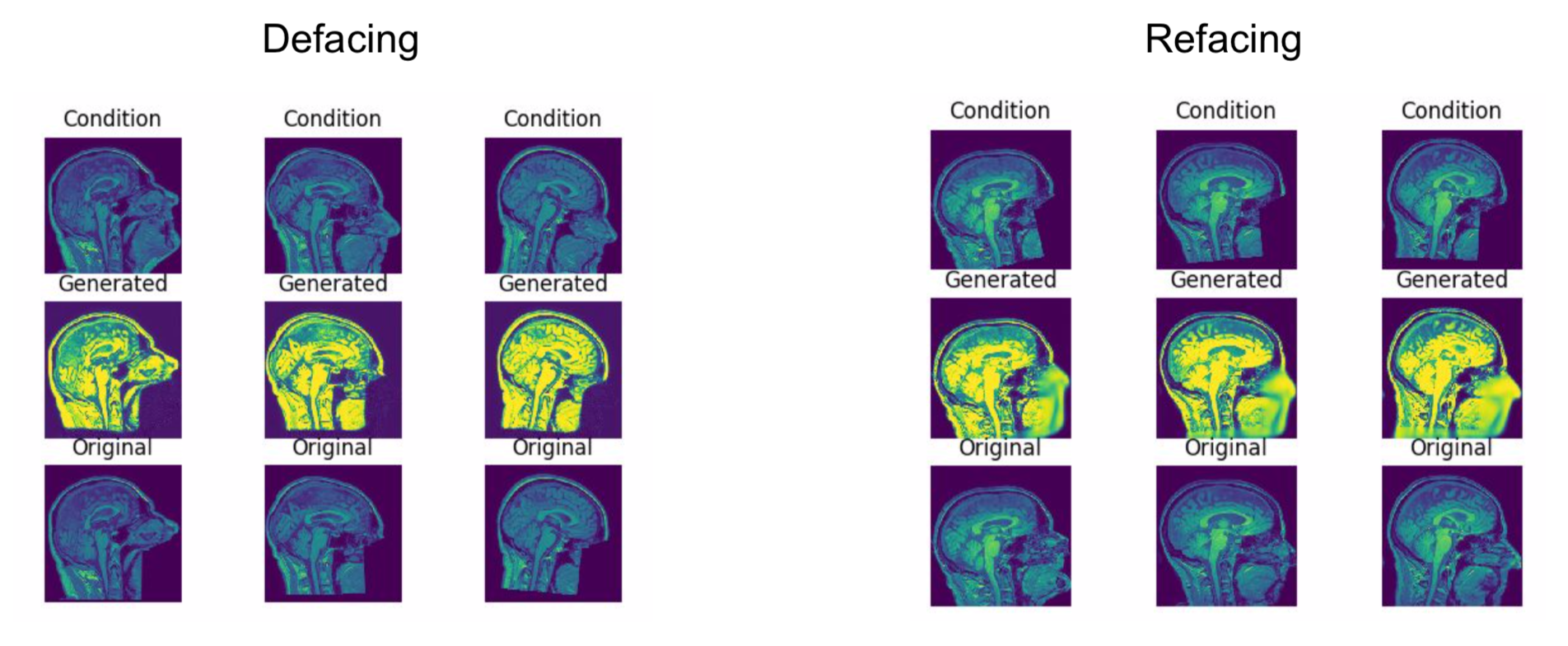GitHub - madhur-tandon/MRI_Defacing: ML Course Project