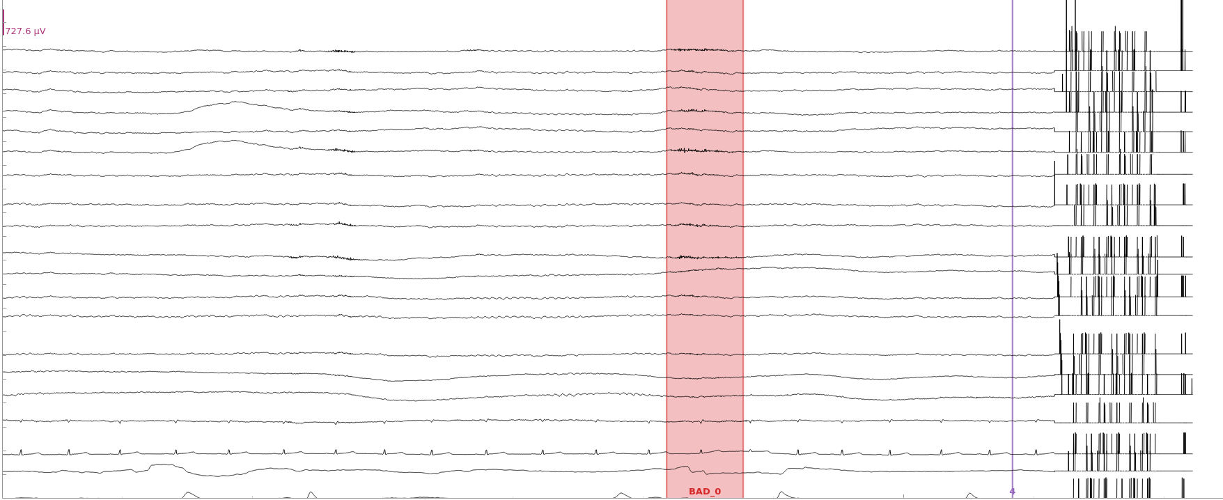 Mne Appends Empty Data At The End Of Raw Object After Cnt Importation · Issue 11802 · Mne Tools