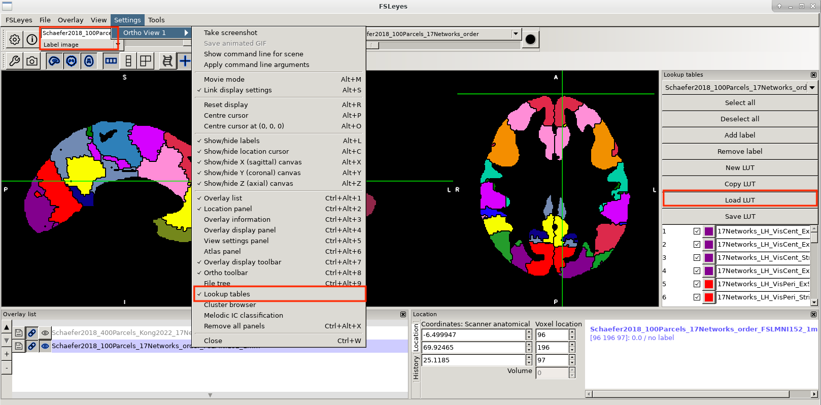 CBIG/stable_projects/brain_parcellation/Schaefer2018_LocalGlobal ...