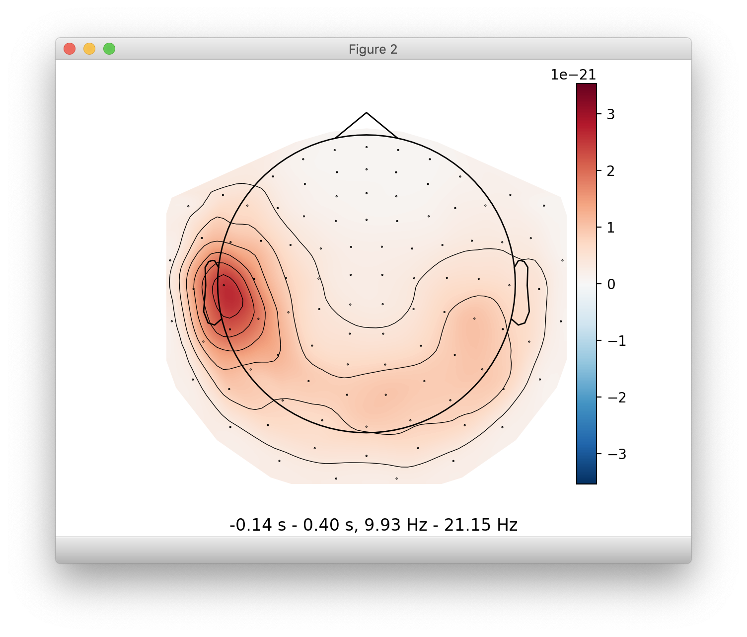 Inconsistent topoplot layout across different TFR plotting functions · Issue #8045 · mne-tools ...