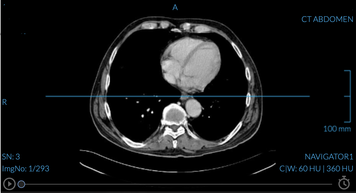 Specific Jpeg Lossless Dicom File Produces Gibberish Pixel Data · Issue