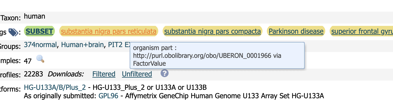 Gemma propagation doesn't recognise substantia nigra as part of the brain and · Issue #842 ...