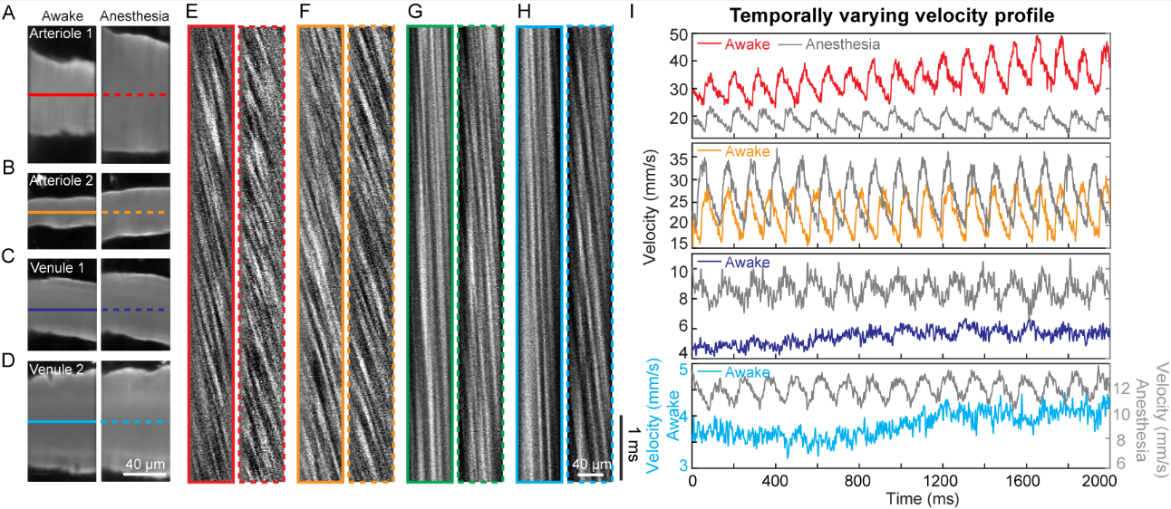 GitHub - JiLabUCBerkeley/FACED2PFM-vessel: Blood flow analysis using ...