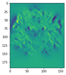 flow field in learn2reg using Pytorch implementation · Issue #165 · voxelmorph/voxelmorph · GitHub