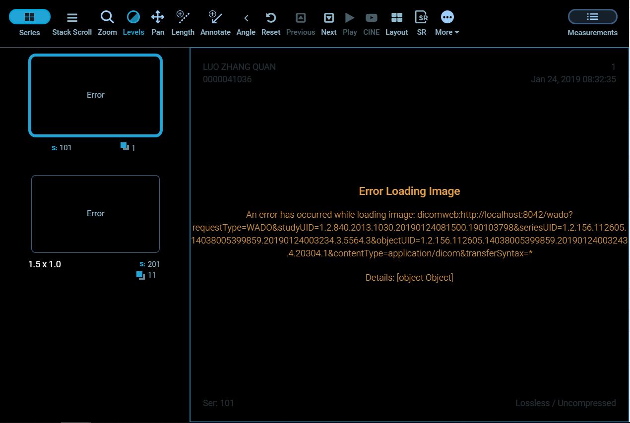 failed to loading image · Issue #397 · OHIF/Viewers · GitHub
