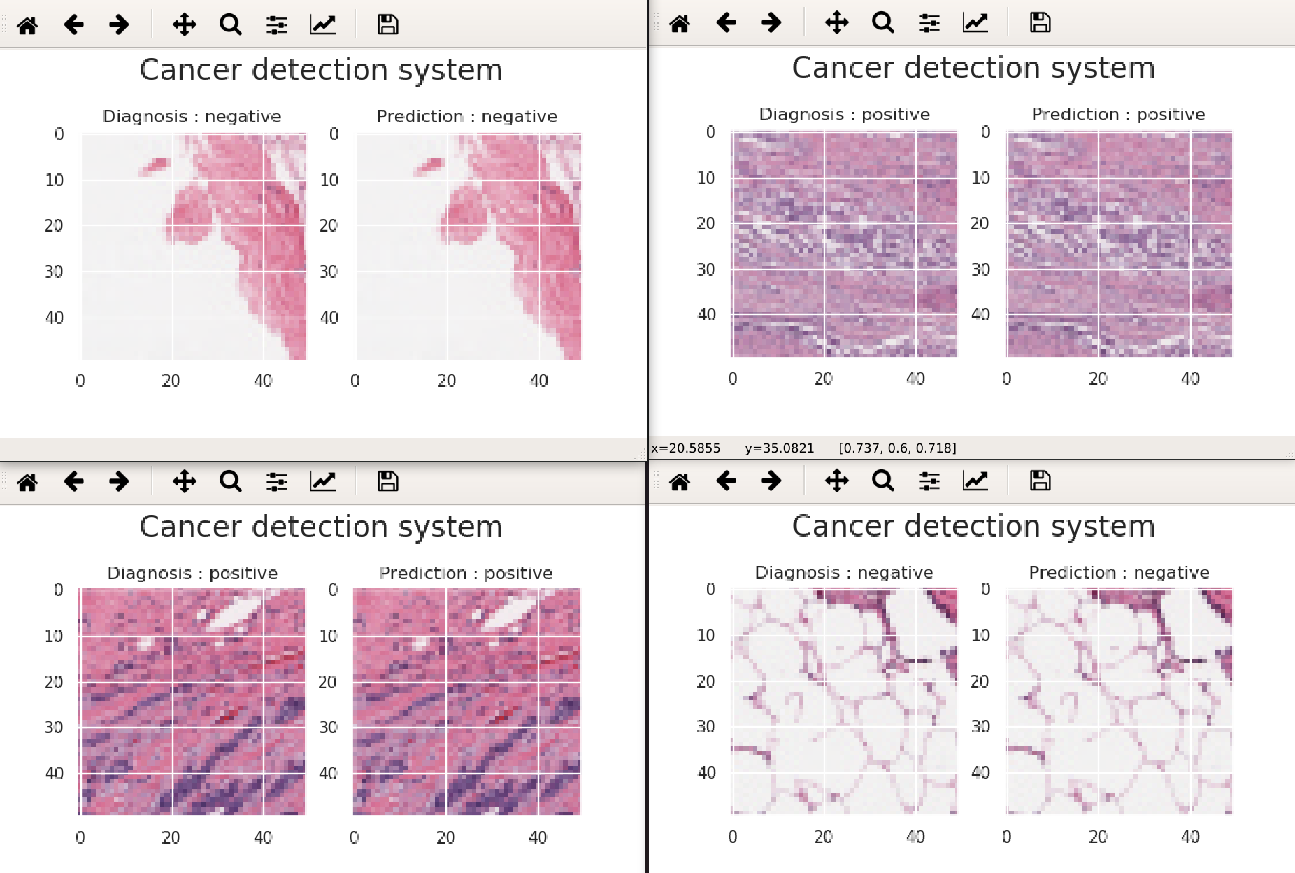 GitHub - MikeG27/Breast-Histology-Images: Cancer detection system based ...