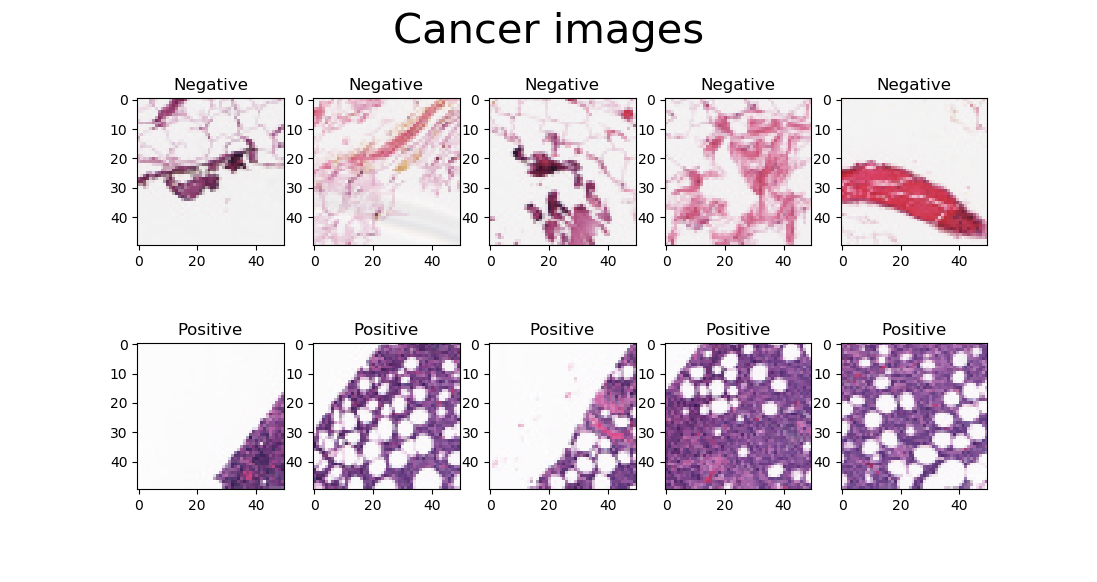 GitHub - MikeG27/Breast-Histology-Images: Cancer detection system based ...