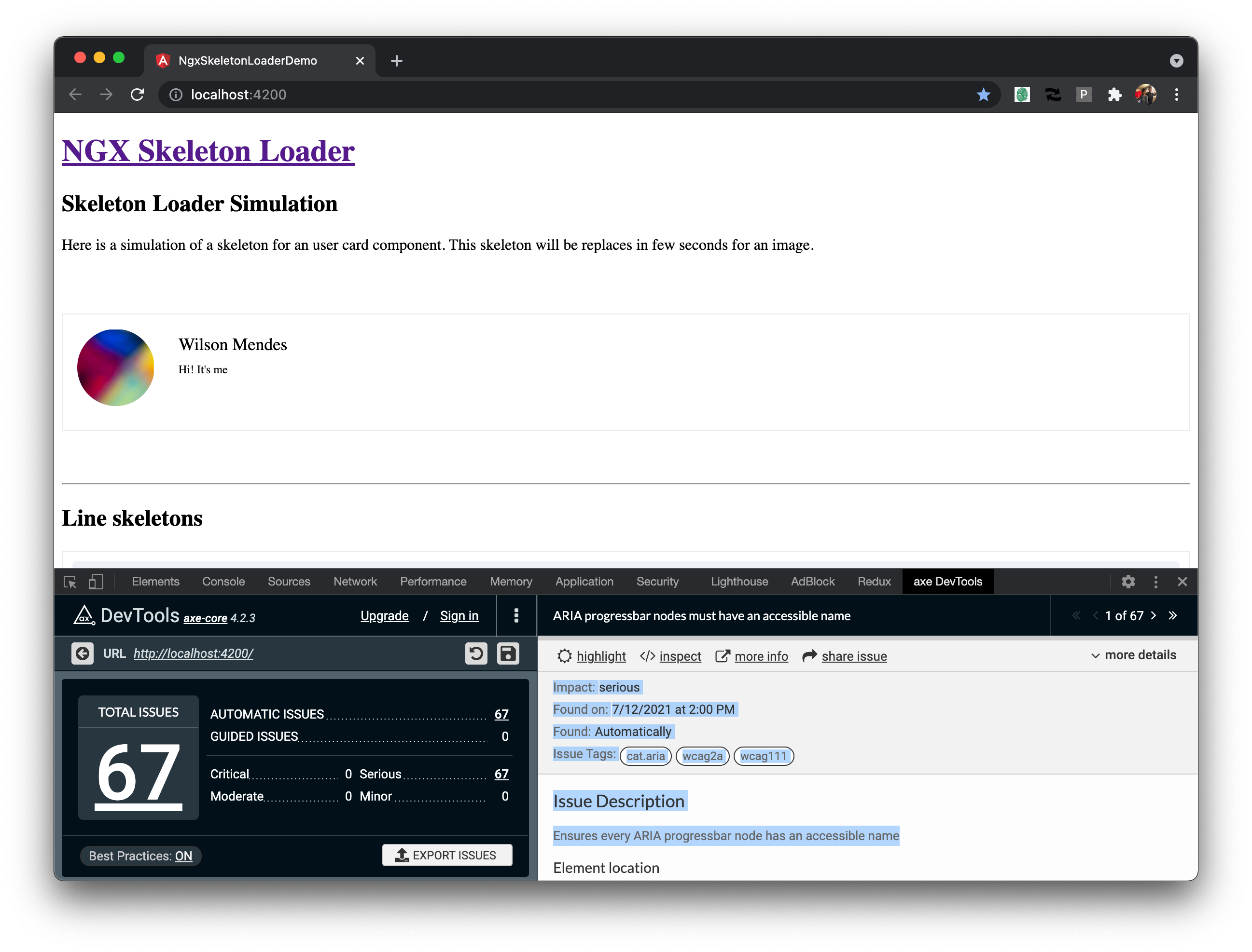 Ensures Every ARIA Progressbar Node Has An Accessible Name Issue 82