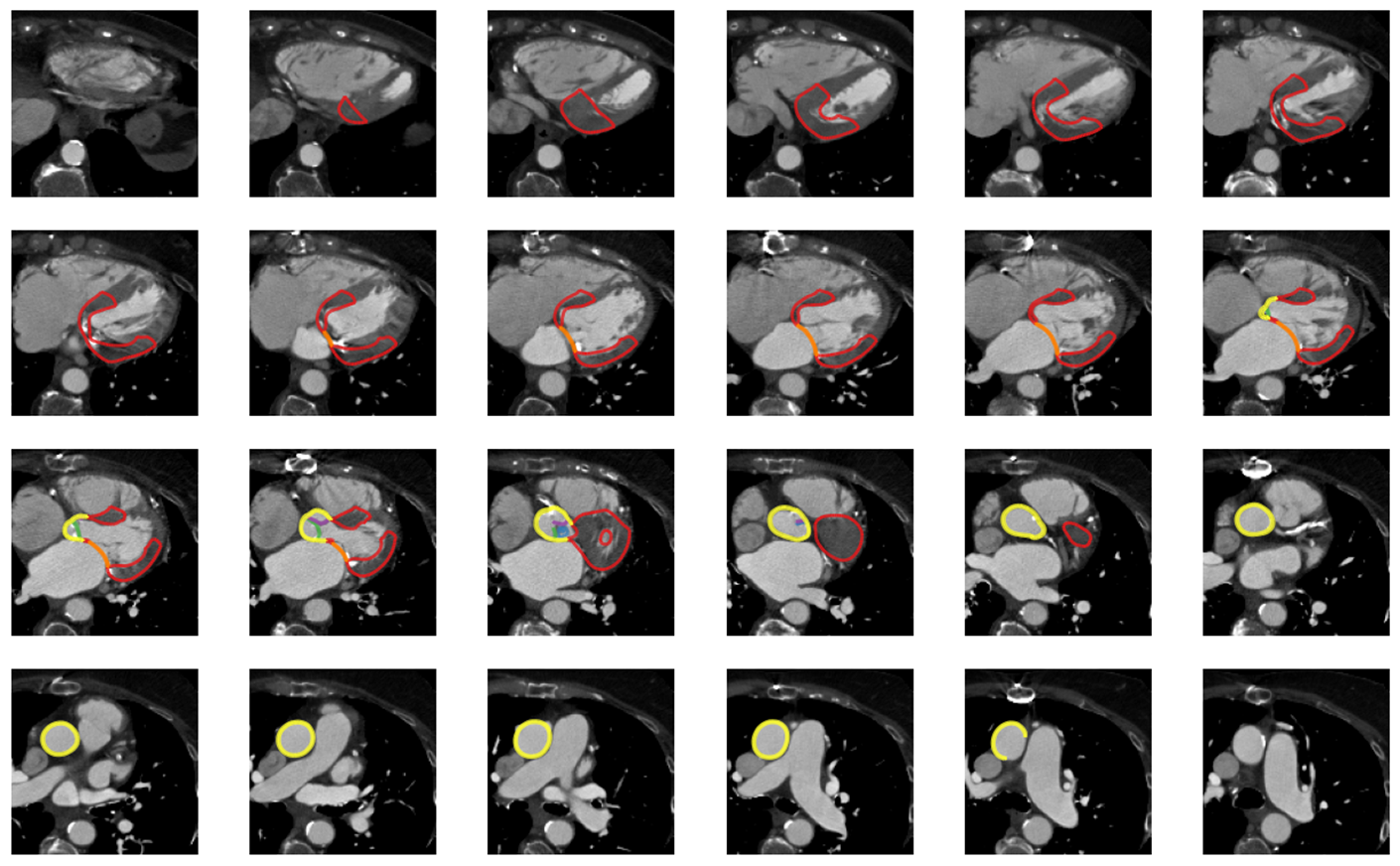 GitHub - danpak94/Deep-Cardiac-Volumetric-Mesh