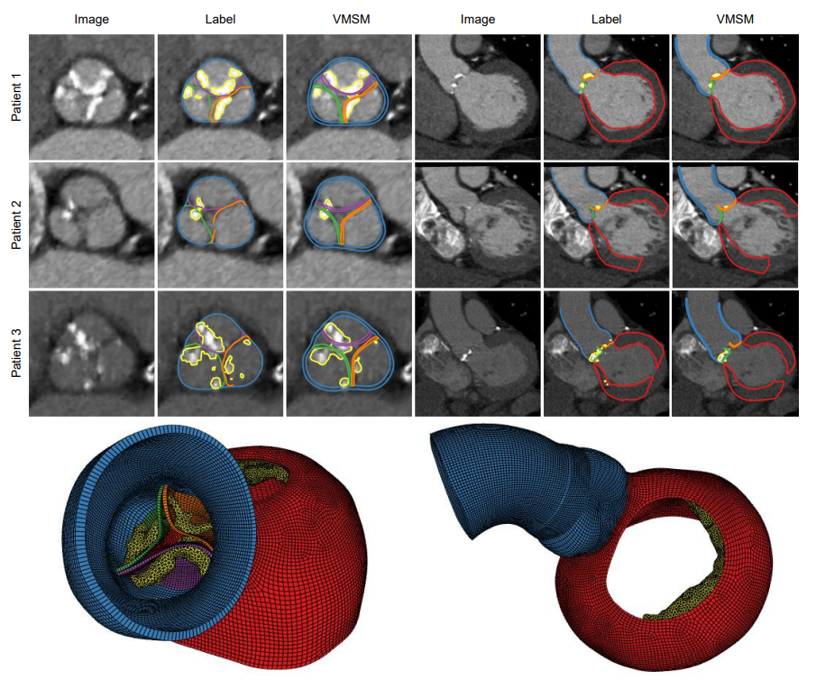 GitHub - danpak94/Deep-Cardiac-Volumetric-Mesh GitHub - danpak94/Deep-Cardiac-Volumetric-Mesh