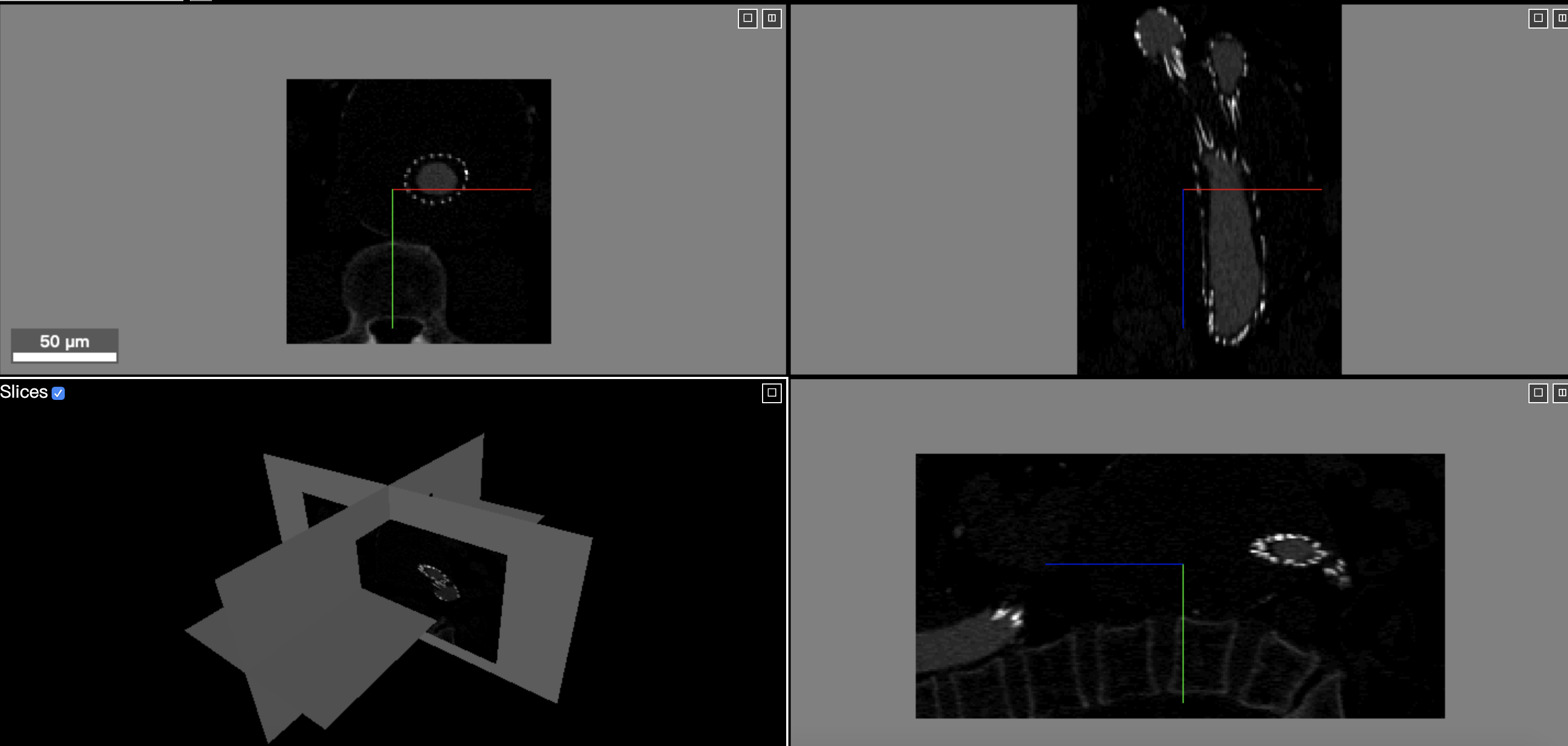 question about volume data rendering · Issue #186 · google/neuroglancer · GitHub