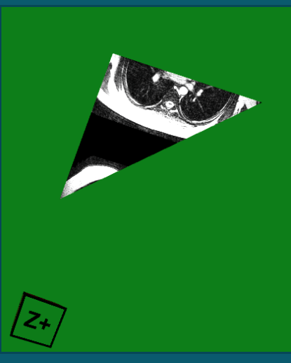 Vtkimageslice And Vtkimagemapper Slice Offset Problem · Issue 916 · Kitwarevtk Js · Github