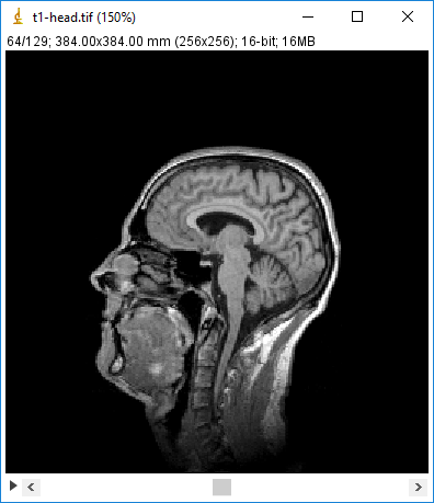 Bad scrollbar handle visibility on Windows 10 using ImageJ 1.52r (and previous versions) · Issue ...