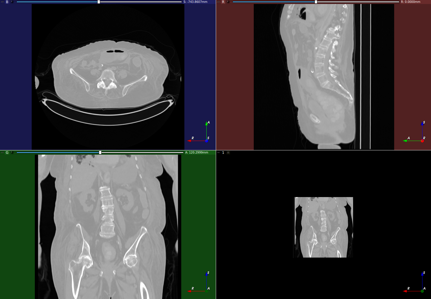 (Priority 1) Vertically Flipped Sagittal & Coronal Orientation · Issue ...