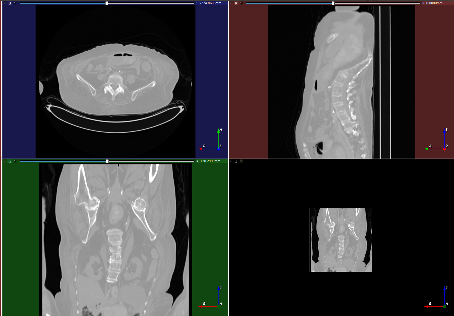 (Priority 1) Vertically Flipped Sagittal & Coronal Orientation · Issue ...