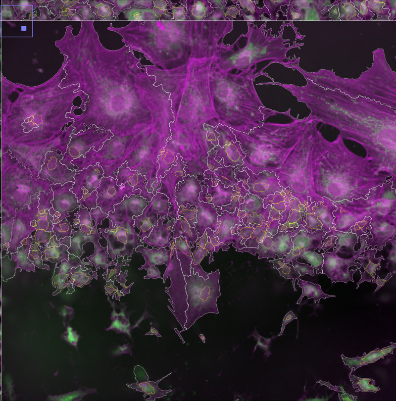 BATCH22_Project_2019_08_03_Adipocyte_CellPainting_Claussnitzer ...