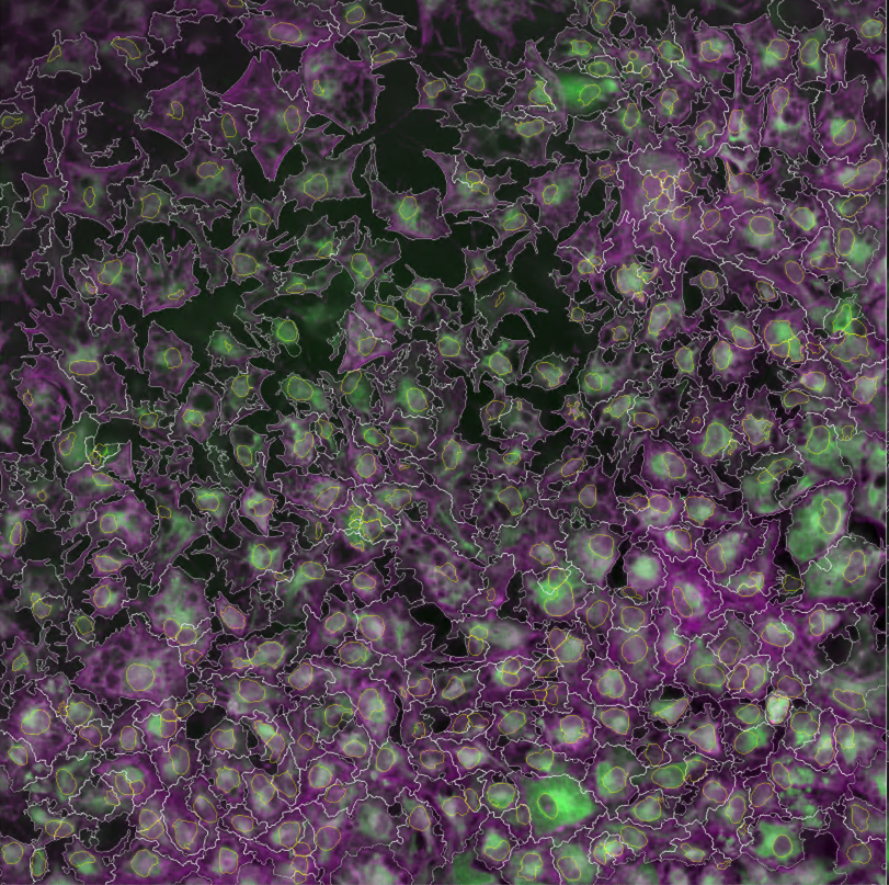 BATCH22_Project_2019_08_03_Adipocyte_CellPainting_Claussnitzer ...