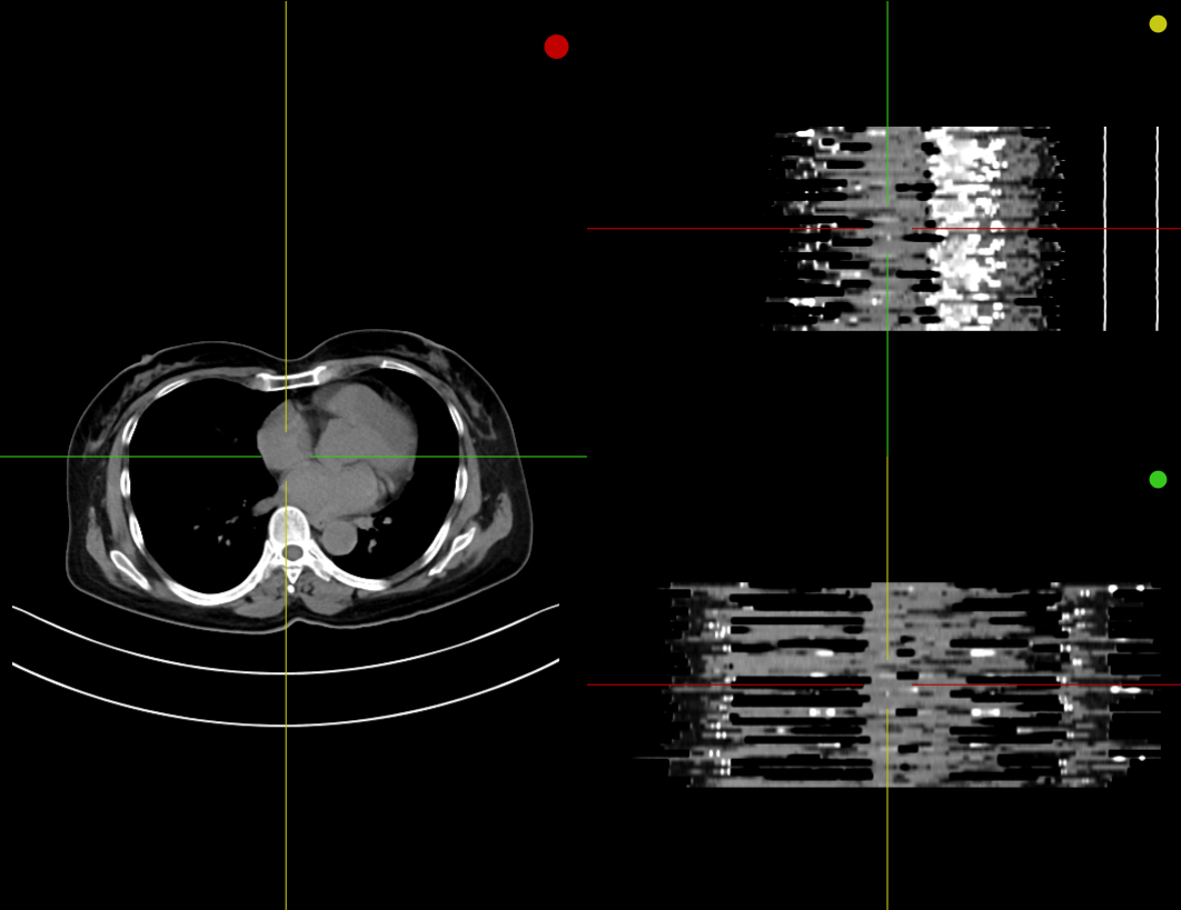 [Bug] · Issue #689 · cornerstonejs/cornerstone3D · GitHub