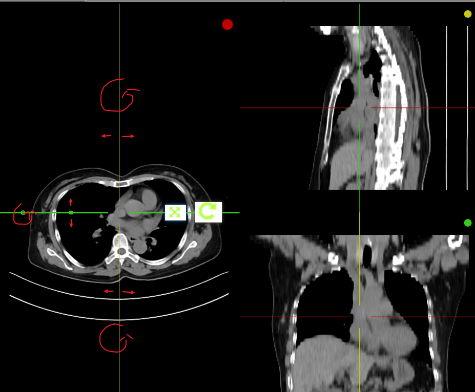 [Feature Request] · Issue #729 · cornerstonejs/cornerstone3D · GitHub