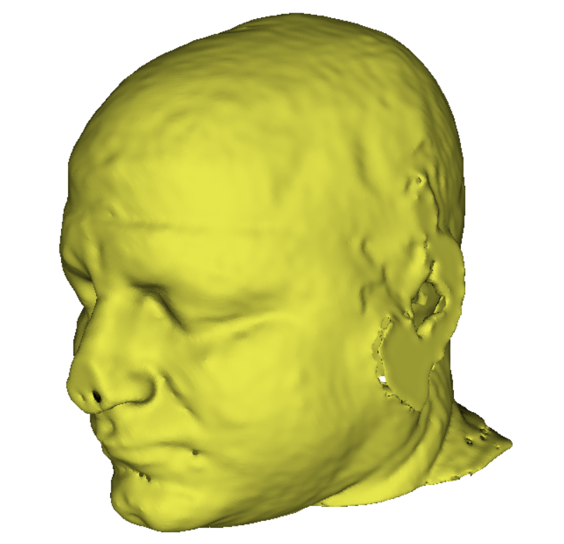 The landmark placing on the MRI head model · Issue #11 · RasmusRPaulsen/Deep-MVLM · GitHub