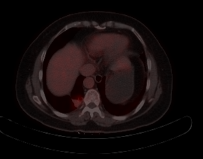 "Cross Crop" for the Image fusion with multi-layers · Issue #1490 ...