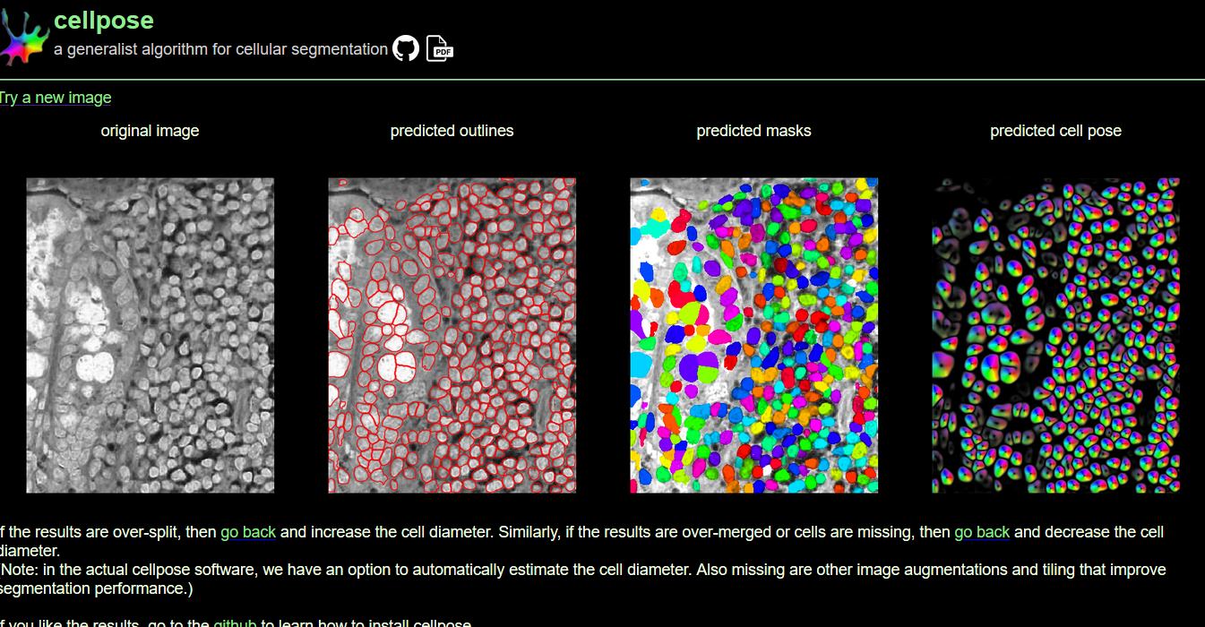 inverting the image intensity as a preprocessing step · Issue #26 · MouseLand/cellpose · GitHub