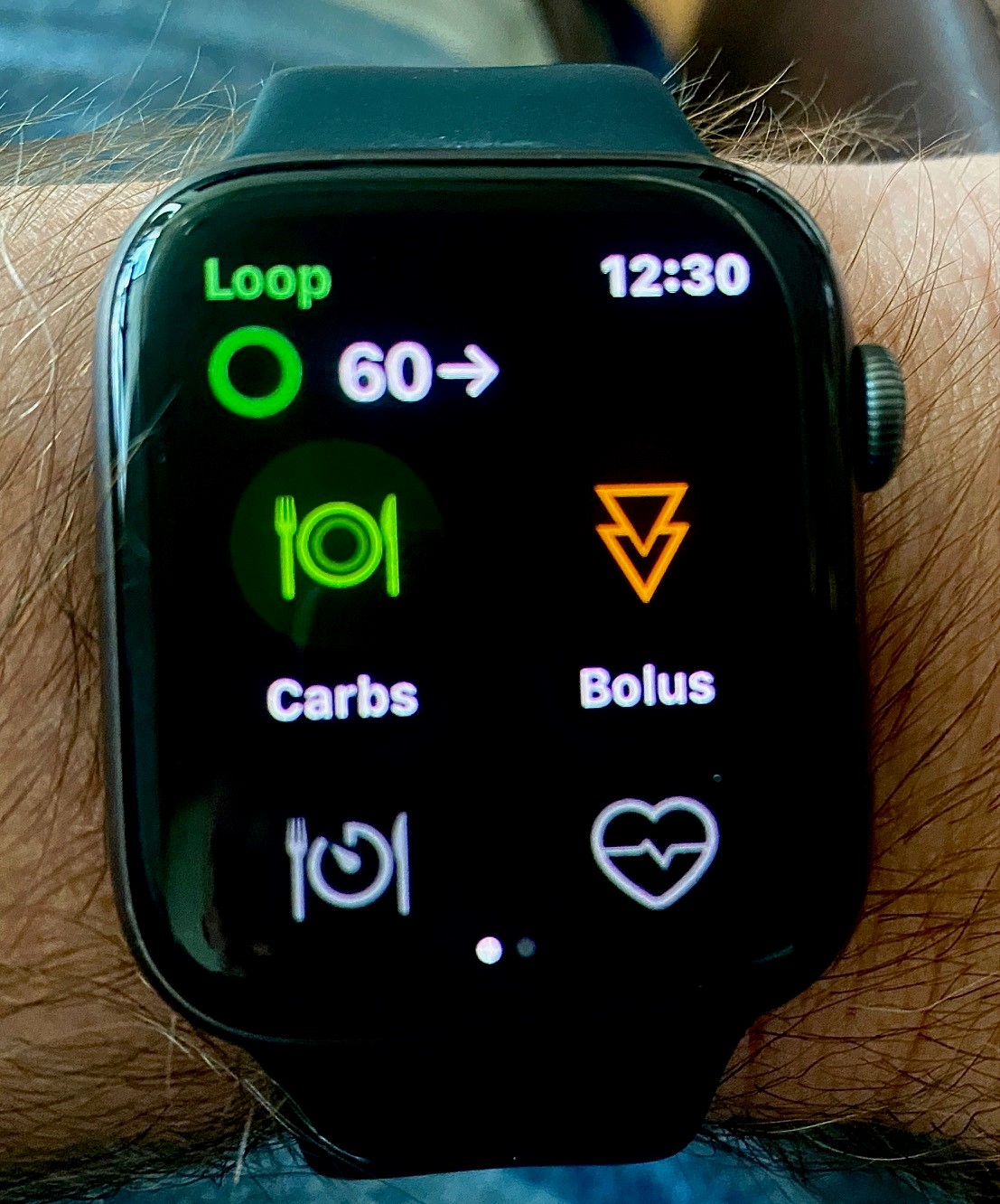 Apple Watch Gray overrides/Pre-Meal · Issue #1761 · LoopKit/Loop · GitHub