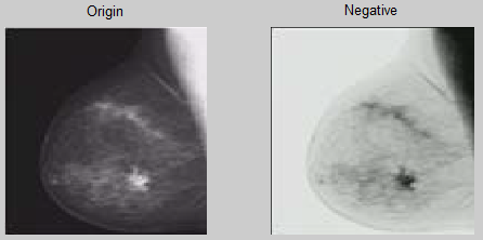 Image Enhancement |图像增强 · Issue #26 · junxnone/ml · GitHub