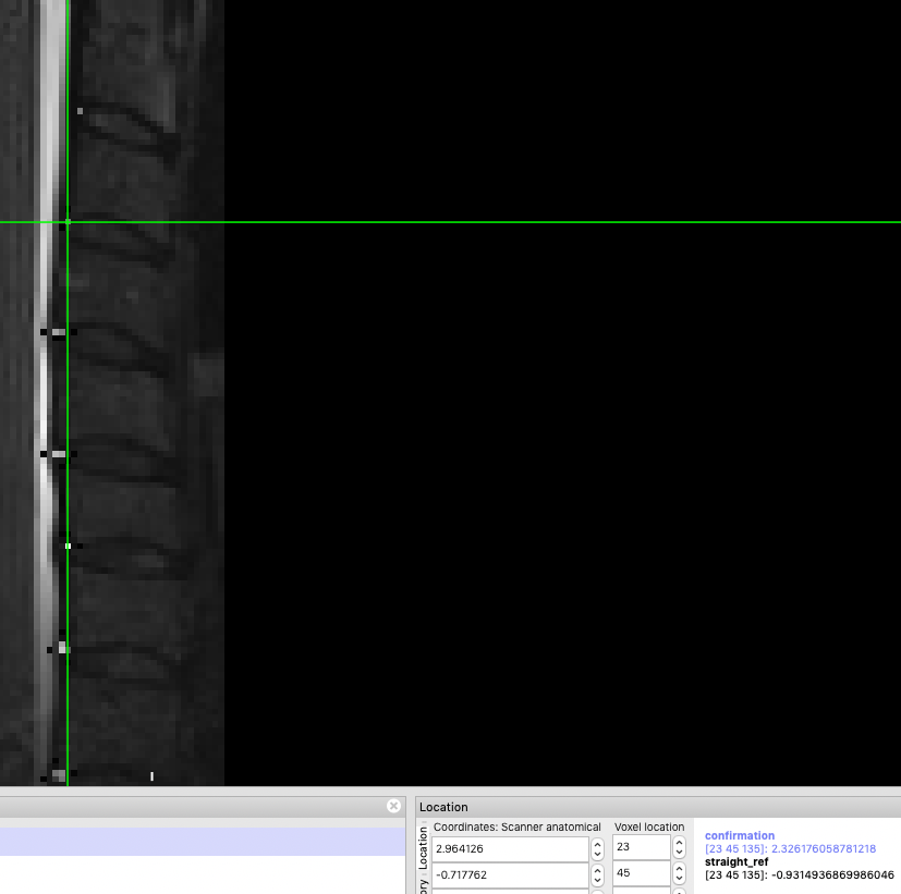 Creation of extra points when using sct_straighten_spinalcord on disc label files · Issue #2519 ...