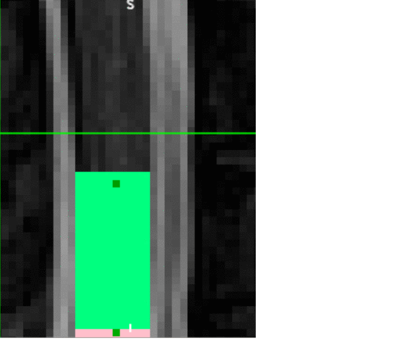 clean_labeled_segmentation add extra slices to the labeled segmentation ...