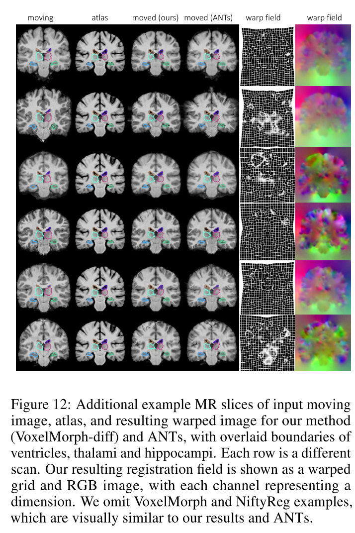 about the jacobian determinant · Issue #50 · voxelmorph/voxelmorph · GitHub