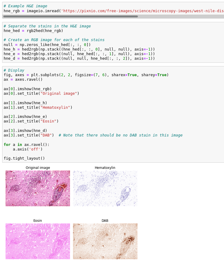Enhance gallery example on color separation of stained tissues · Issue ...