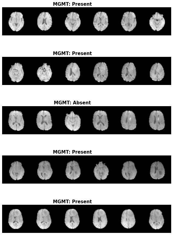 GitHub - pranavAL/MRI-Classification-Kaggle
