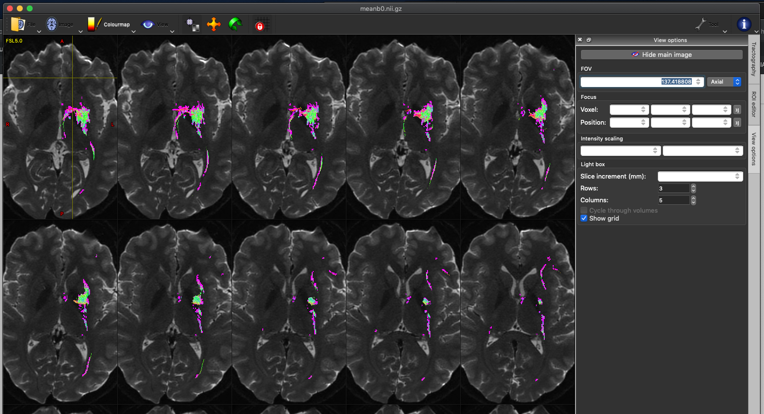 macOS Mojave dark mode issues · Issue #1520 · MRtrix3/mrtrix3 · GitHub