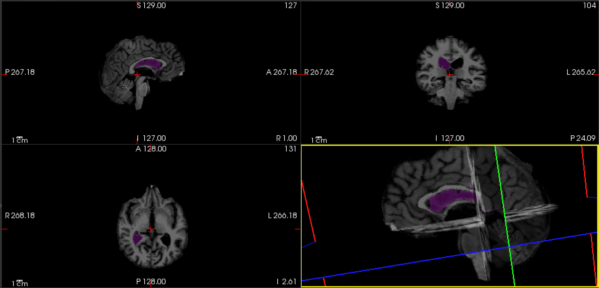 Volumetric Meshes · Issue #131 · ranahanocka/MeshCNN · GitHub