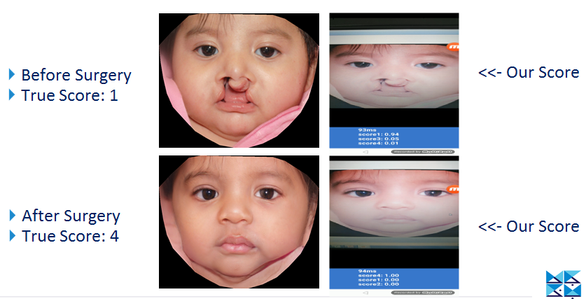 GitHub - MdShafiqu/Facial-Anomaly-Detection