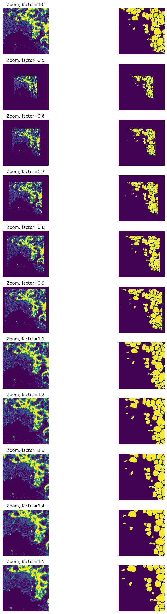 Training log · Issue #30 · angelolab/Nimbus · GitHub