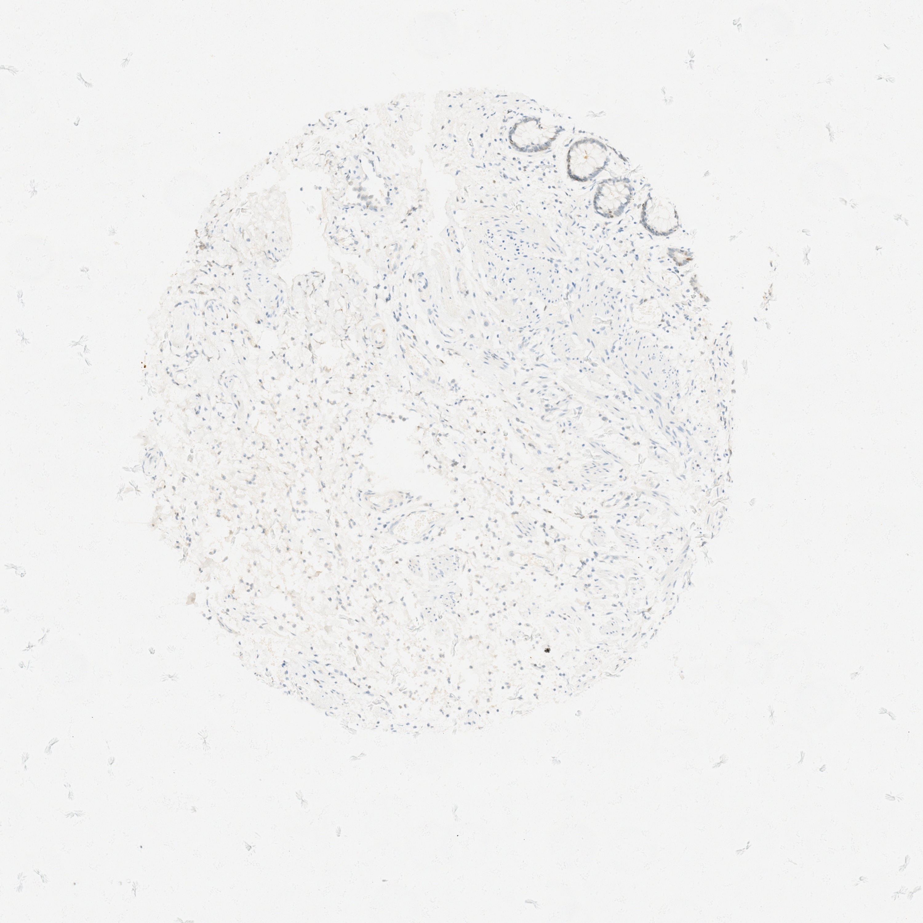 Bad Segmentation with Large IHC Images · Issue #26 · nadeemlab/DeepLIIF · GitHub