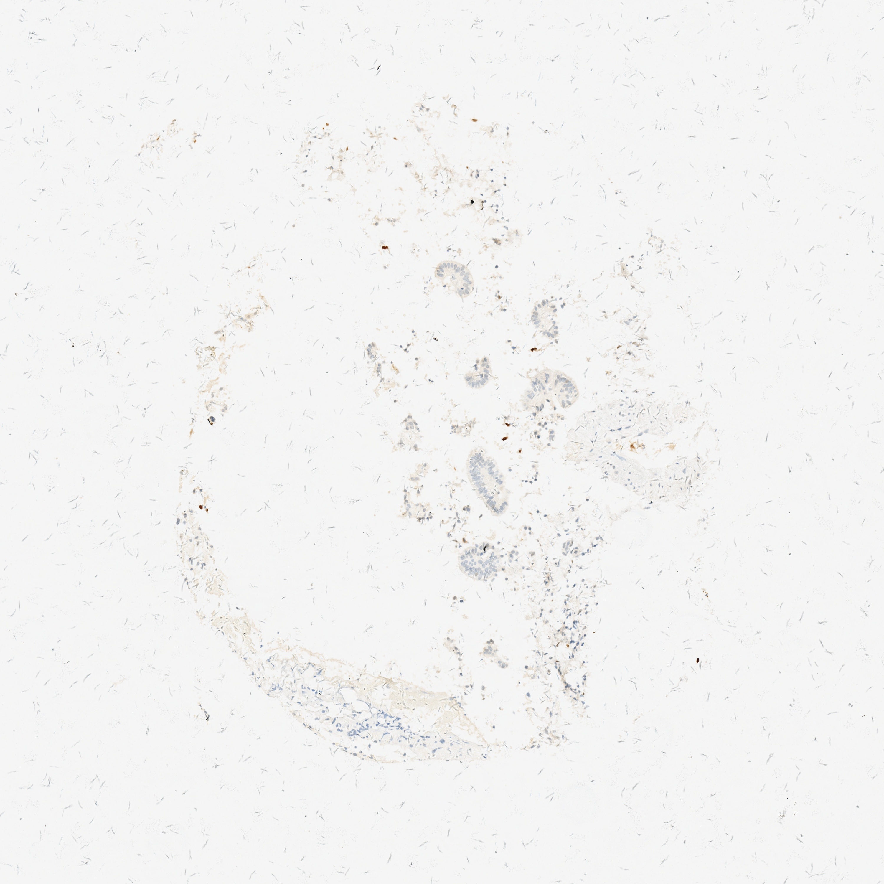 Bad Segmentation with Large IHC Images · Issue #26 · nadeemlab/DeepLIIF · GitHub