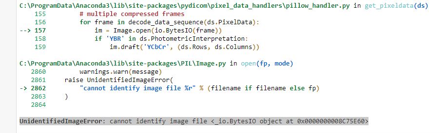 How Can I Add Jpeg2KImagePlugin to Decompress a Dicom File · Issue #1046 · pydicom/pydicom · GitHub