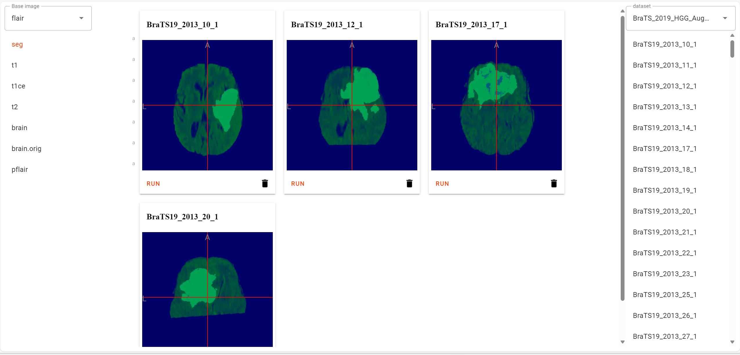 GL context lost when creating many viewers · Issue #698 · niivue/niivue · GitHub