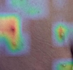 GitHub - Nuwanga-Wijamuni/MonkeypoxCNN: Monkeypox is a viral disease that can spread through ...