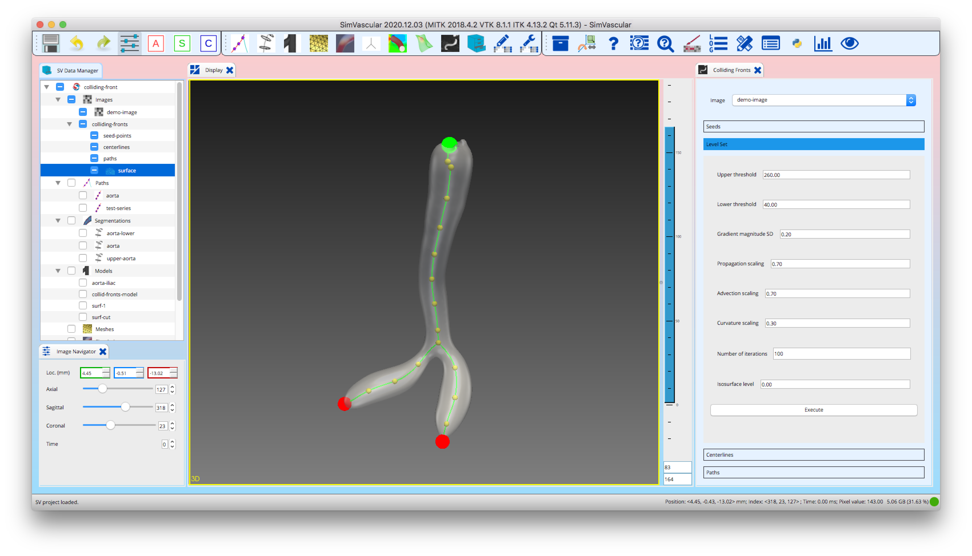Colliding front - fixing crashes and adding features · Issue #706 · SimVascular/SimVascular · GitHub