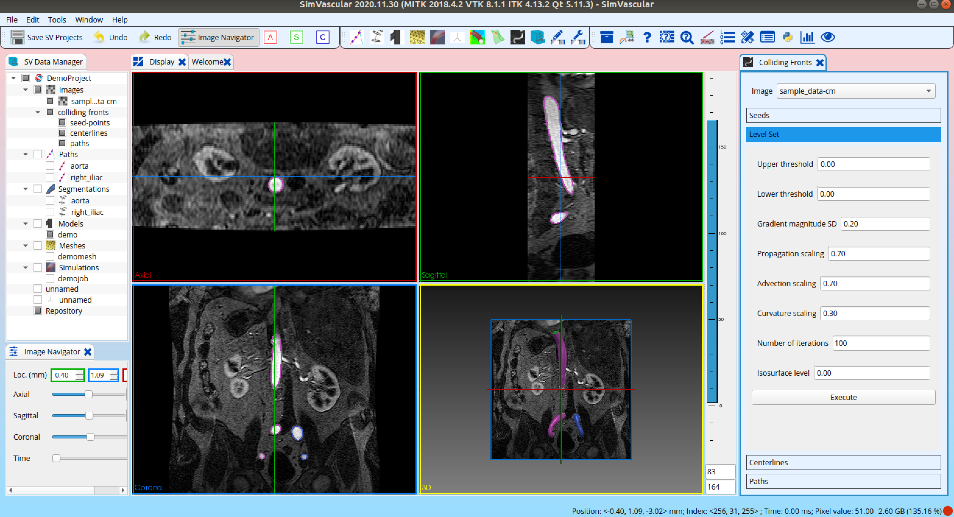 Colliding front - fixing crashes and adding features · Issue #706 · SimVascular/SimVascular · GitHub